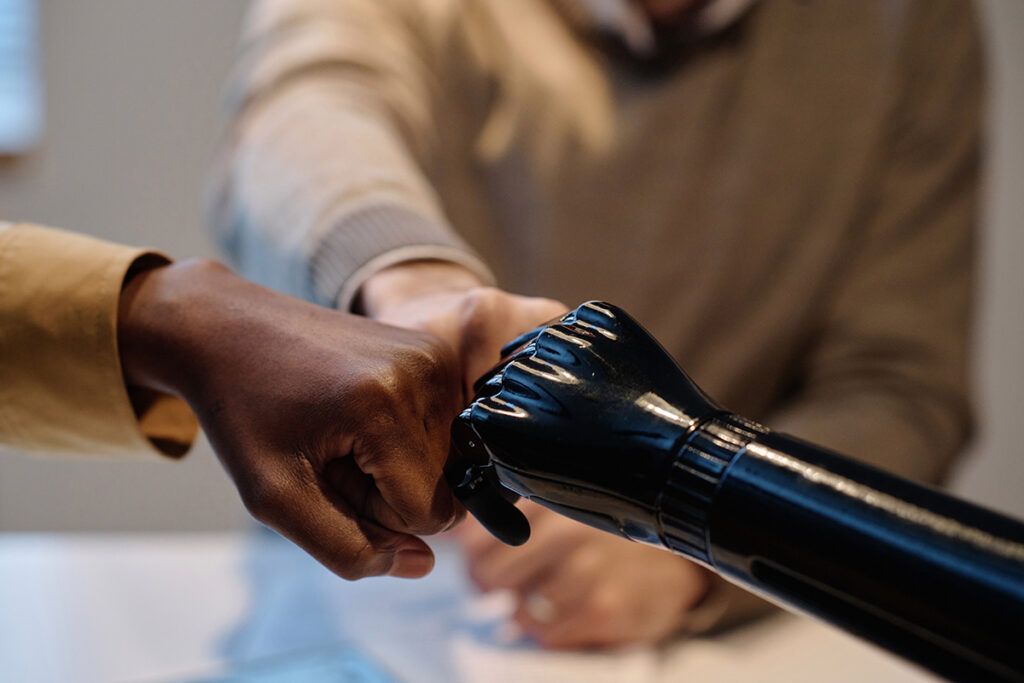Mind-Controlled Prosthetic Hand Revolutionizes Limb Replacement